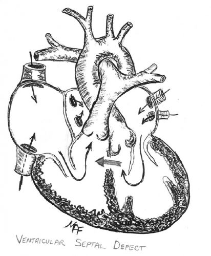 Patient Education - NY Kids Hearts